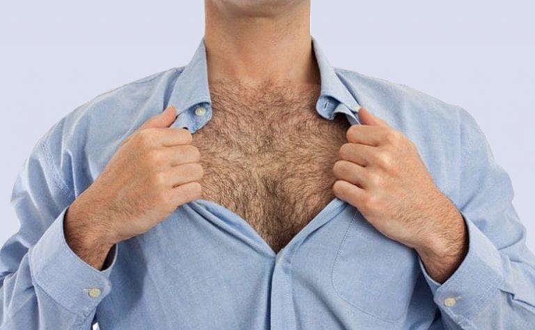 Hair Growth | Beard Transplant | Hair Transplant Clinic